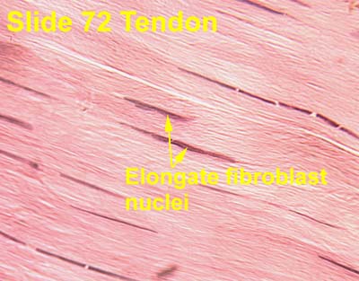 Tendon Tissue Labeled